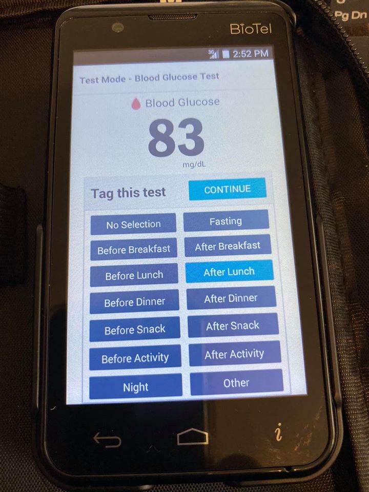 Can Diabetic Eat Red Potatoes – How To Reverse Type 2 Diabetes Naturally